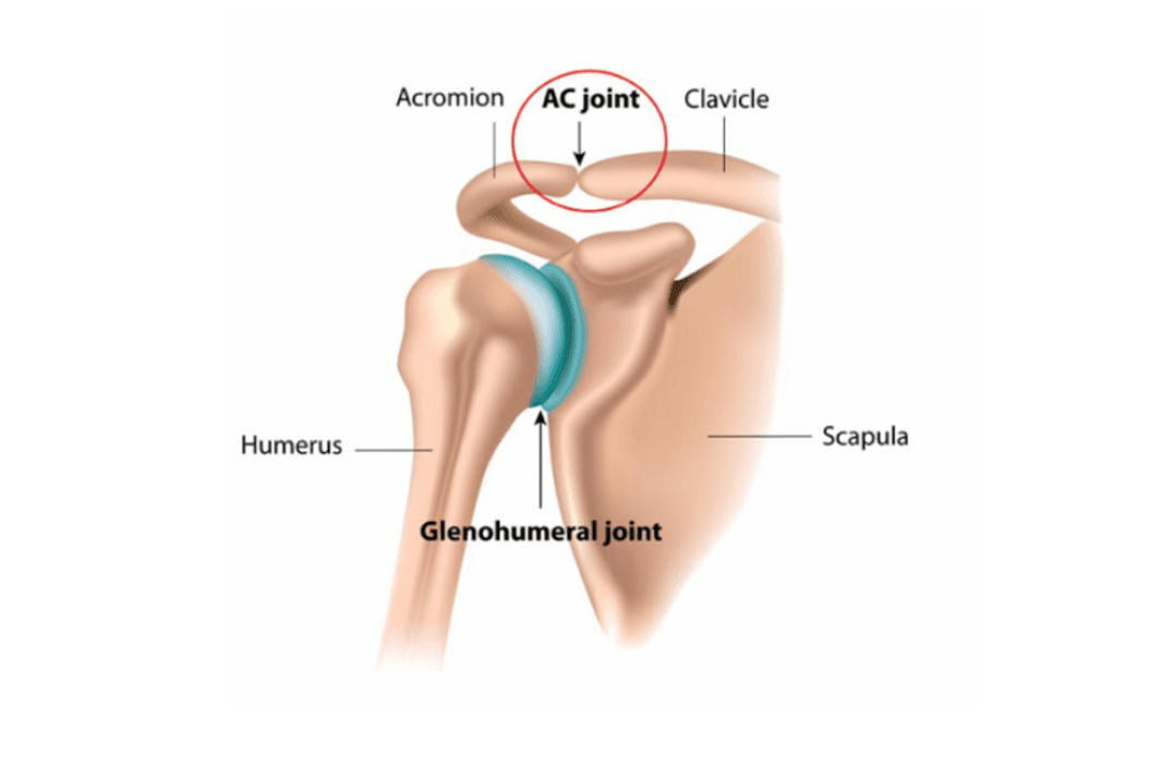 Acromioclavicular Joint Pain Ultrasound Guided Injections Acromioclavicular Joint Pain Ultrasound Guided Injections